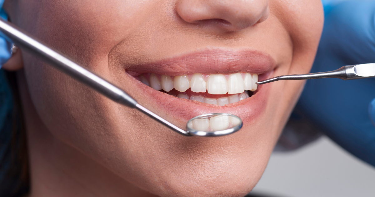 What to Expect When Getting Dentures: A Practical Guide for Your New ...